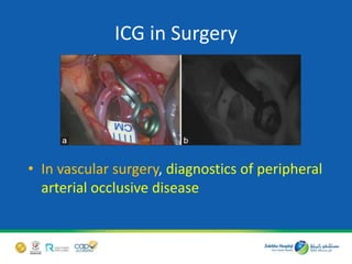 ICG Florence in general and onco surgery | PPTX