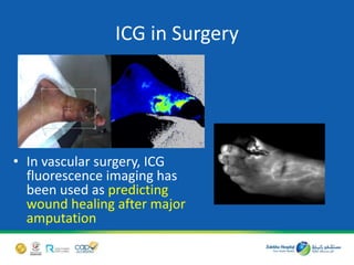 ICG Florence in general and onco surgery | PPTX