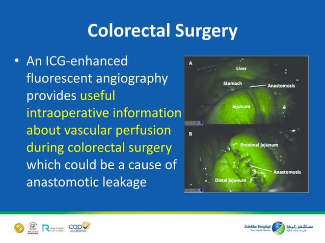 ICG Florence in general and onco surgery | PPTX | Digestive Disorders ...
