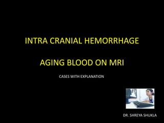 INTRA CRANIAL HEMORRHAGE- AGING BLOOD ON MRI | PPTX