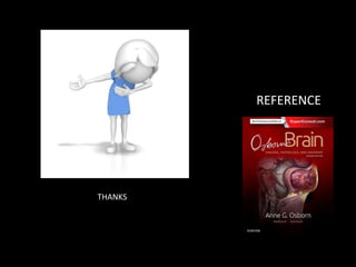 INTRA CRANIAL HEMORRHAGE- AGING BLOOD ON MRI | PPTX