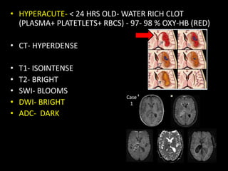INTRA CRANIAL HEMORRHAGE- AGING BLOOD ON MRI | PPT