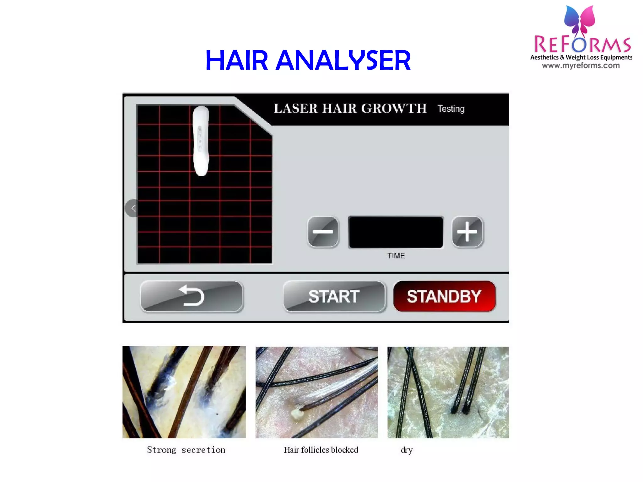 Ichikami Laser Regrowth System | PDF