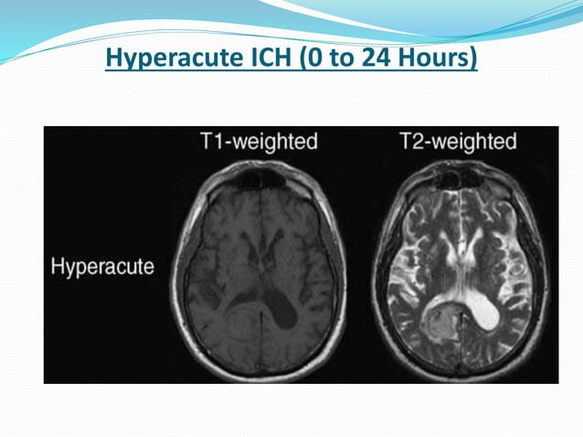 Ich imaging mbs kota | PPTX