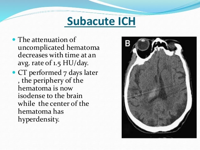 Ich imaging mbs kota