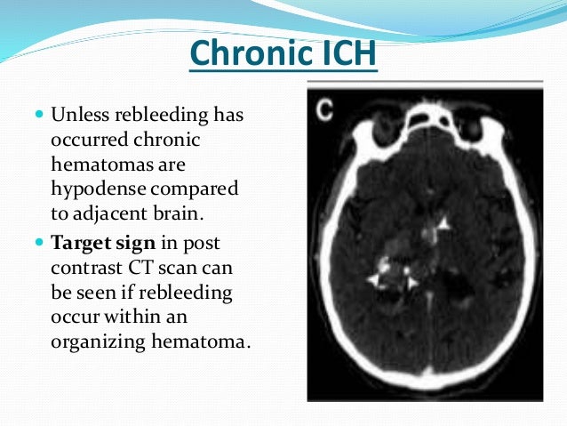 Ich imaging mbs kota
