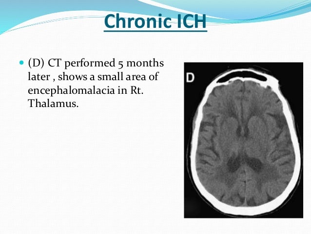 Ich imaging mbs kota