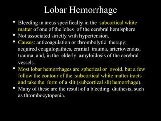 Intracerebral hemorhage Diagnosis and management | PPTX