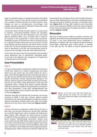 Oral Furosemide Therapy in Patients with Exudative Retinal Detachment Due to Hypertensive ...