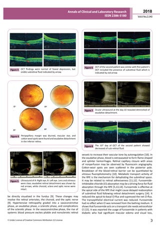 Oral Furosemide Therapy in Patients with Exudative Retinal Detachment Due to Hypertensive ...