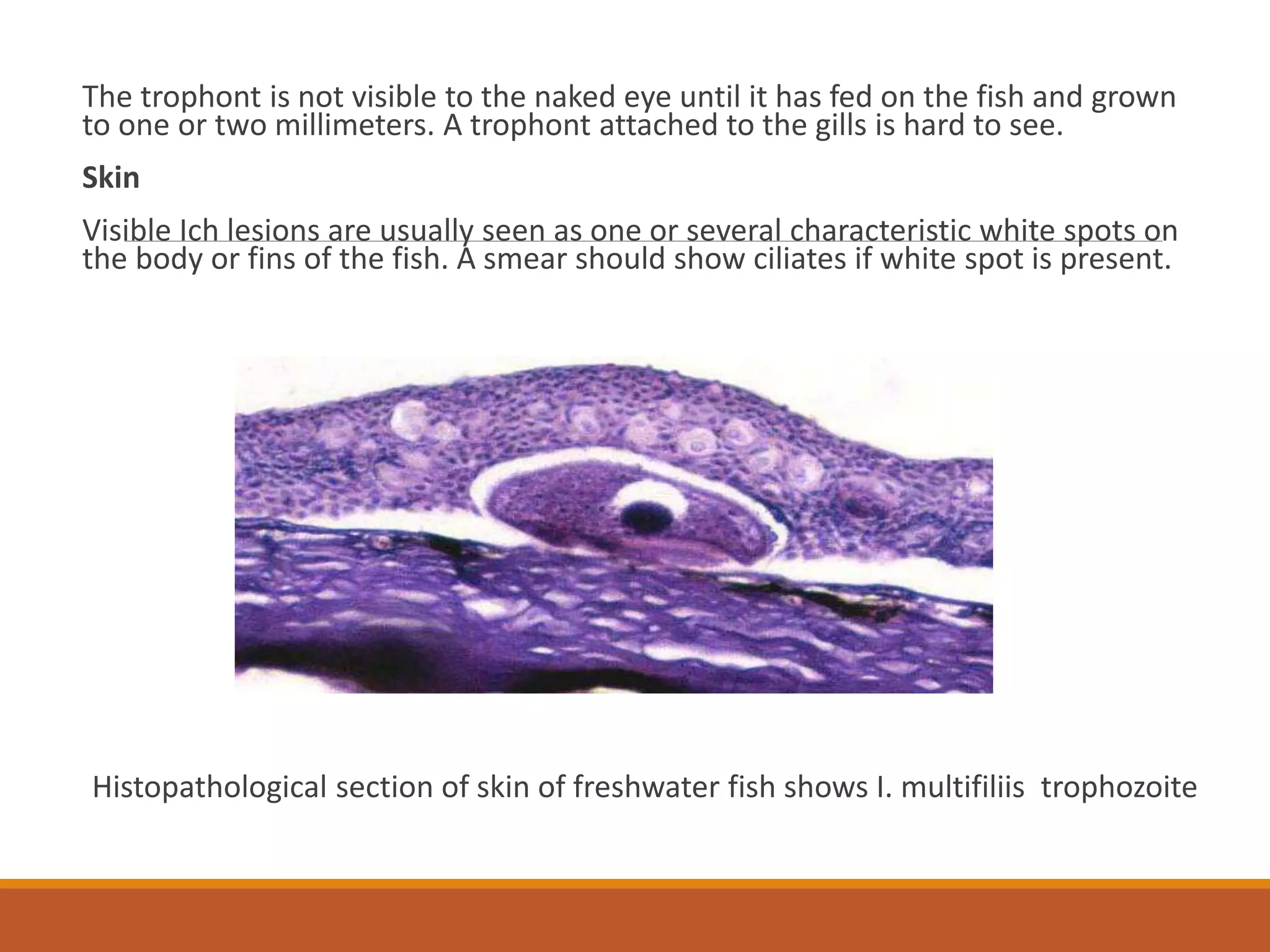 Ichthyophthiriasis | PPTX