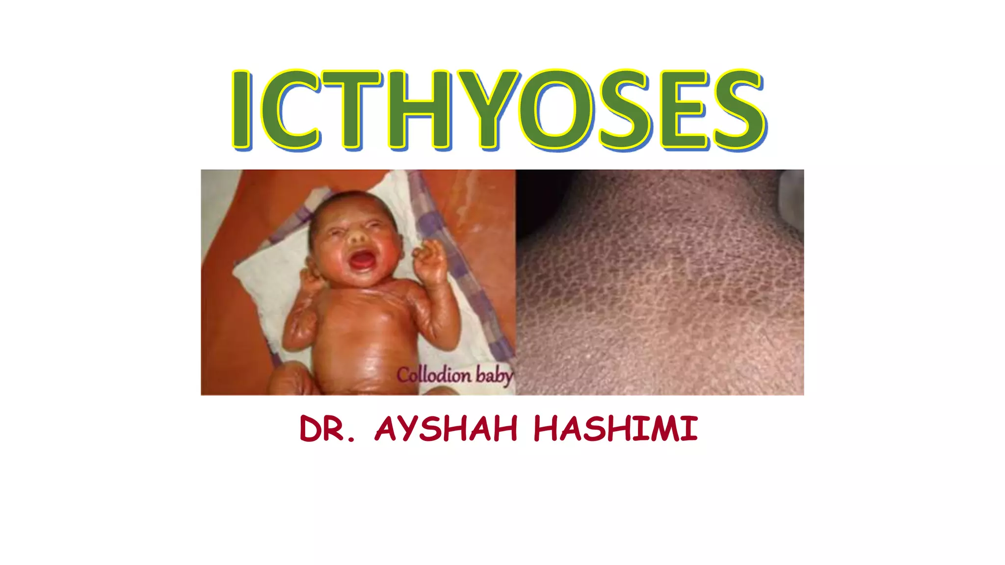 Ichthyoses | PPT