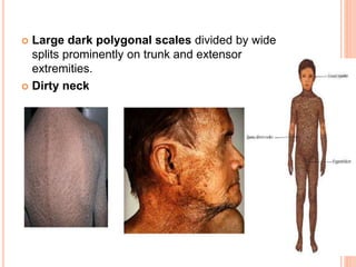 Ichthyoses and ichthyosiform | PPT