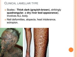 Ichthyoses and ichthyosiform | PPT