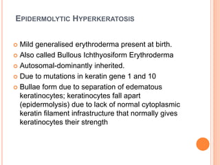 Ichthyoses and ichthyosiform | PPT