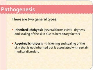 Ichthyosis | PPTX