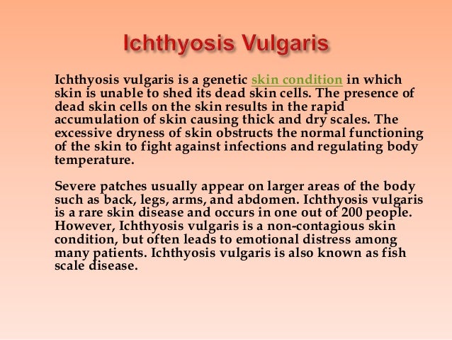 Ichthyosis Vulgaris