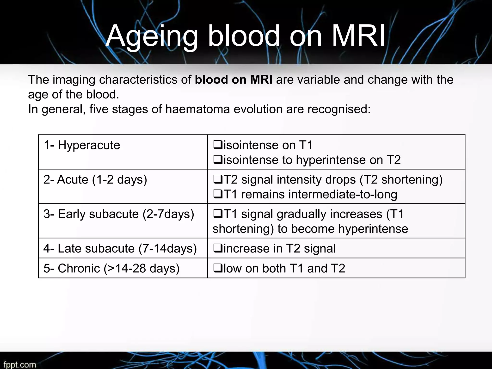 Intracerebral Hemorrhage Case presentation | PPTX