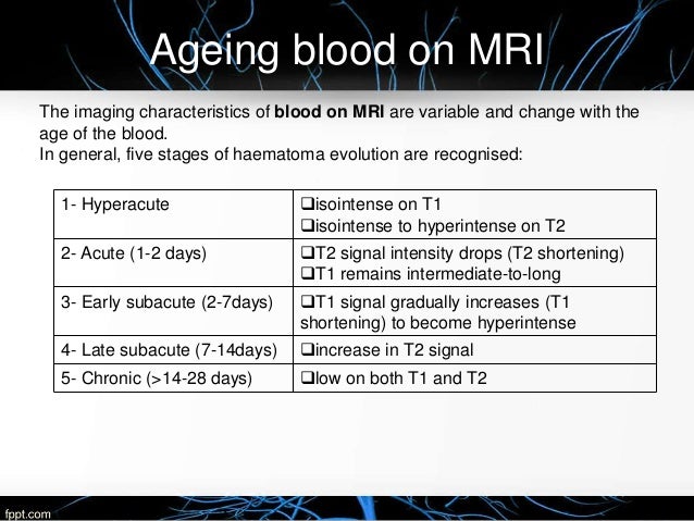 Intracerebral Hemorrhage Case presentation