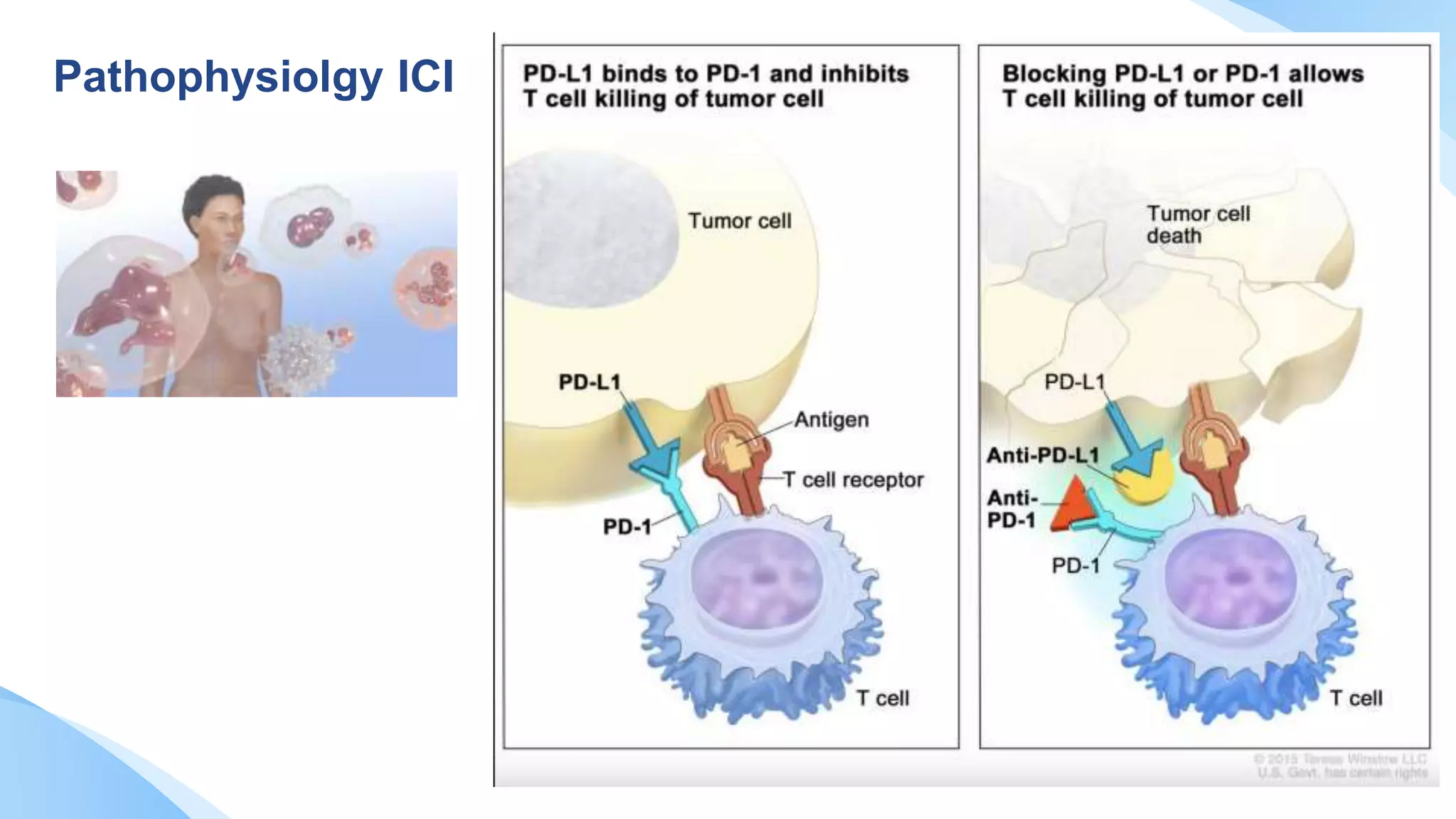 ICI MYOCARDITIS .pptx