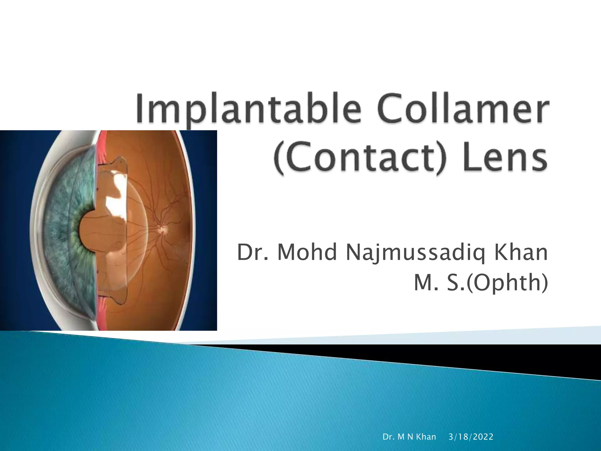 Implantable Collamer (Contact) Lens | PPTX