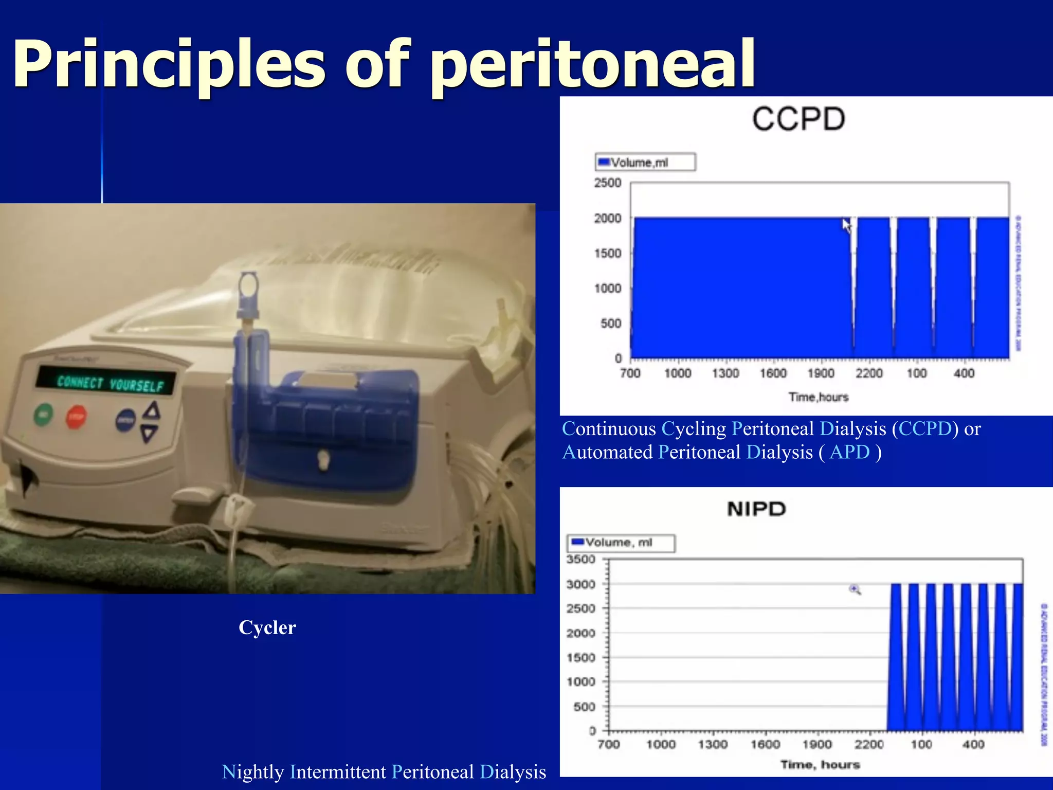 Icm peritoneal dialysis 23 4 | PPT