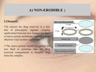 ocular drug delivary system..... | PPT
