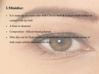 ocular drug delivary system..... | PPT