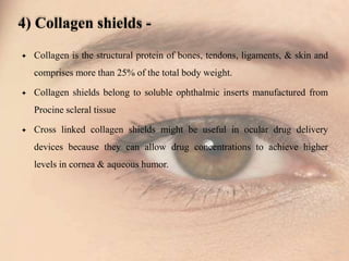 ocular drug delivary system..... | PPT
