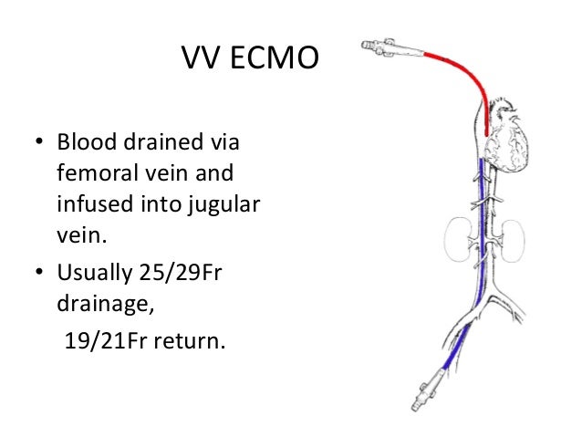Vv Ecmo Circuit Vv ECMO Gas Exchange | Resus Review