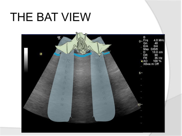 The Basics of Lung Ultrasound | PPTX
