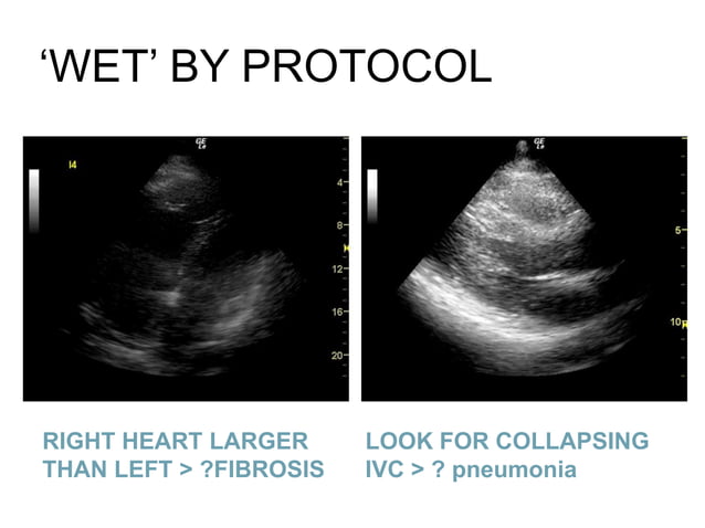 The Basics of Lung Ultrasound | PPTX