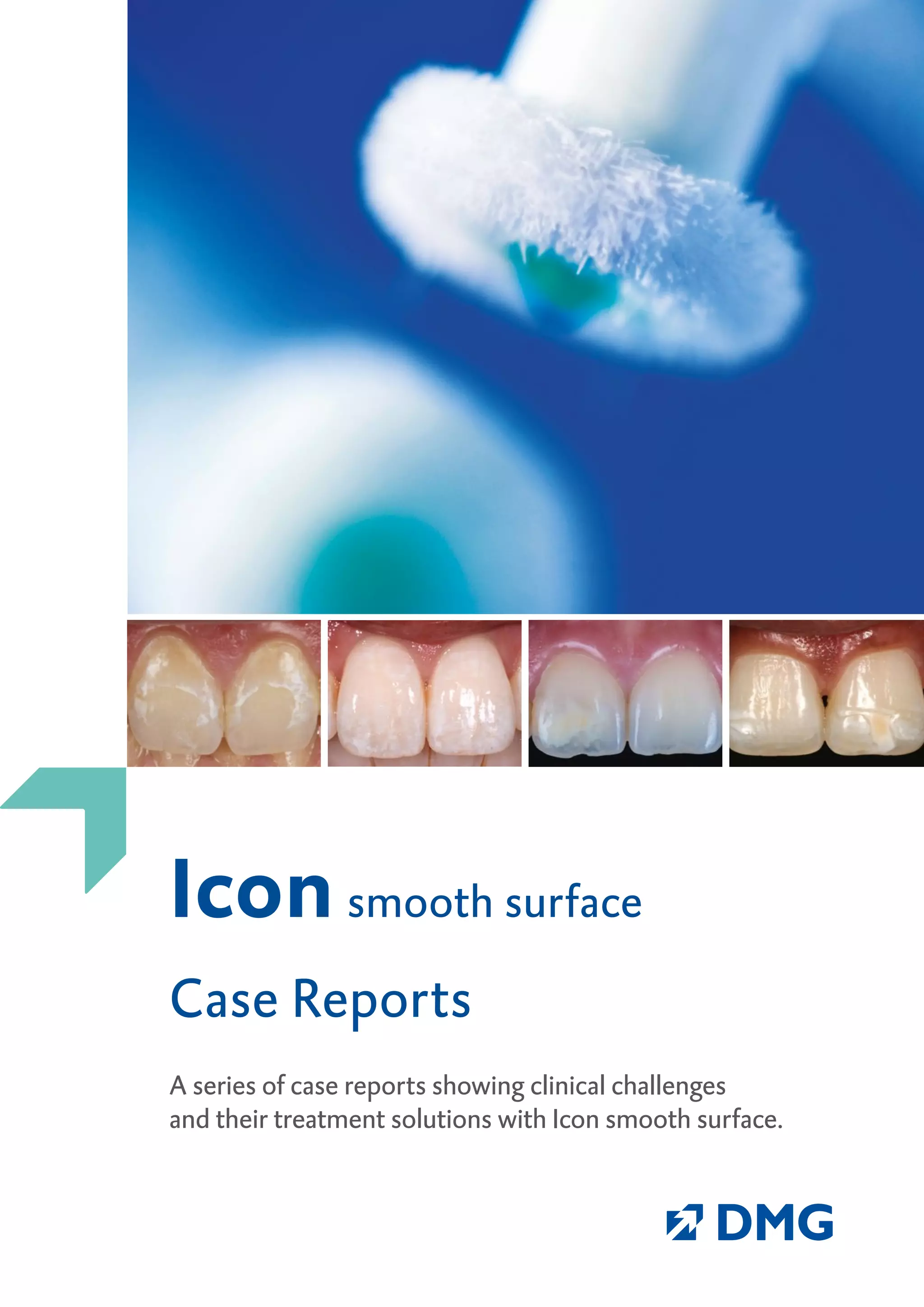 Icon case reports | PDF