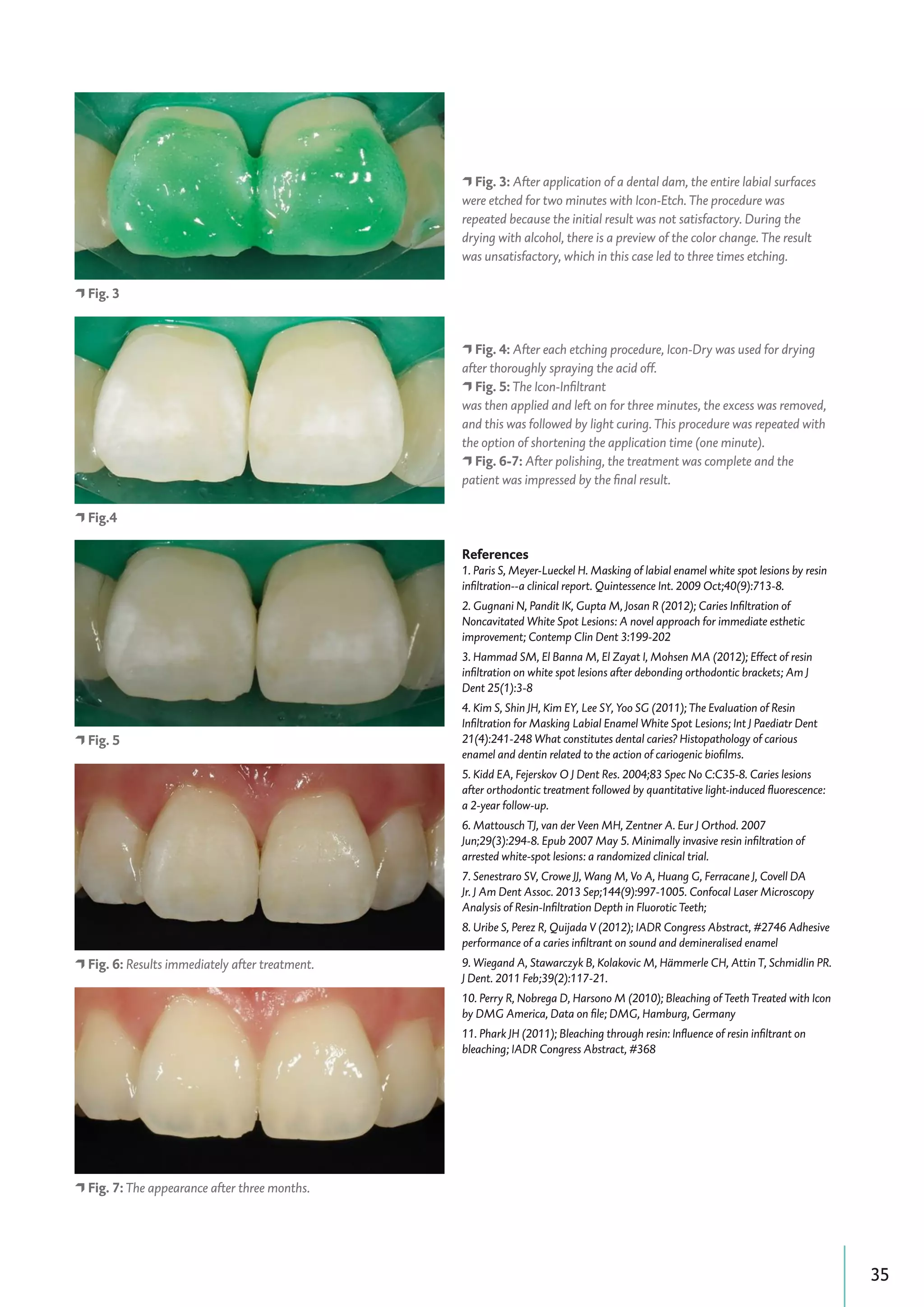 Icon case reports | PDF