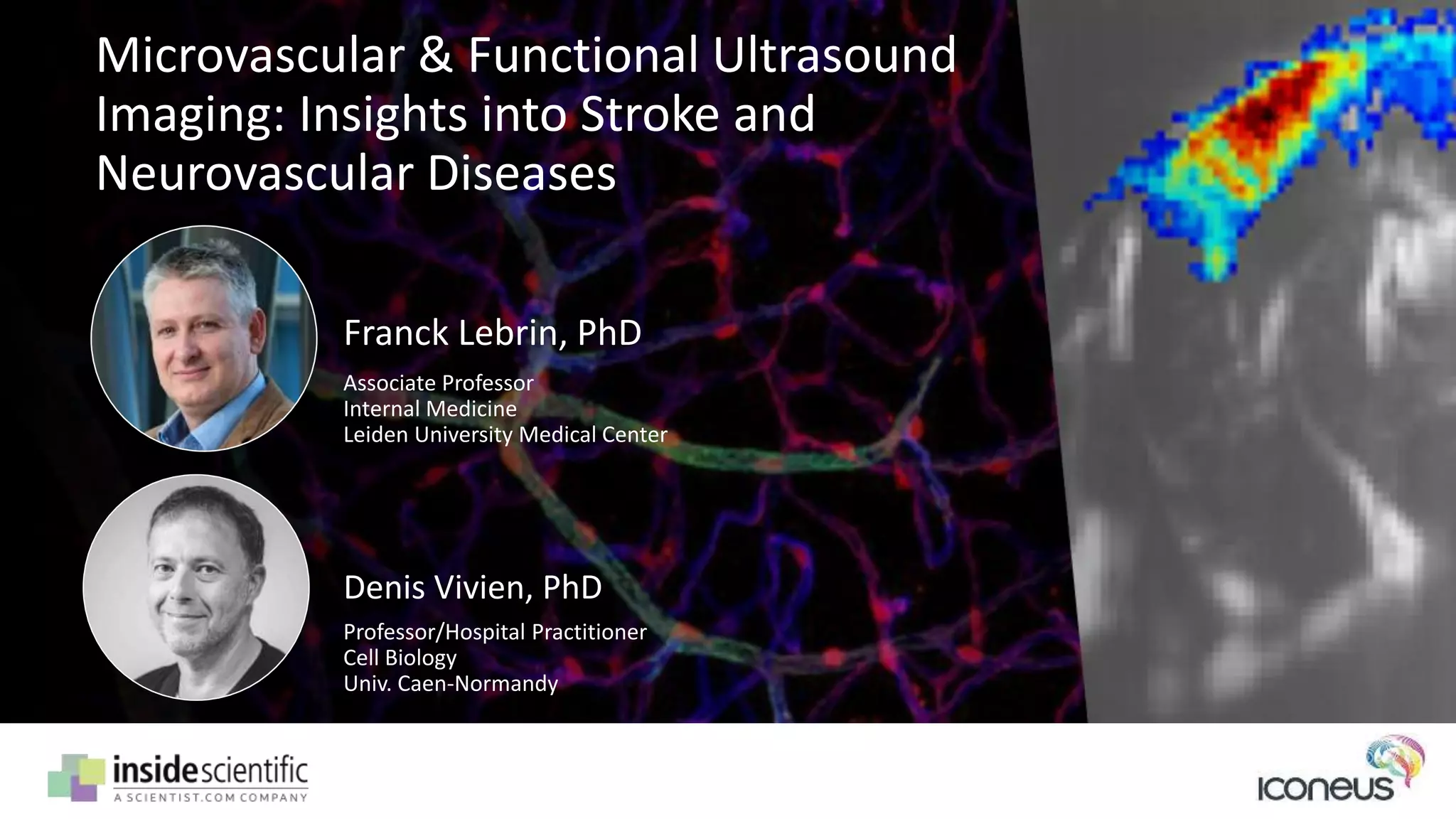 Microvascular & Functional Ultrasound Imaging: Insights into Stroke and Neurovascular Diseases ...