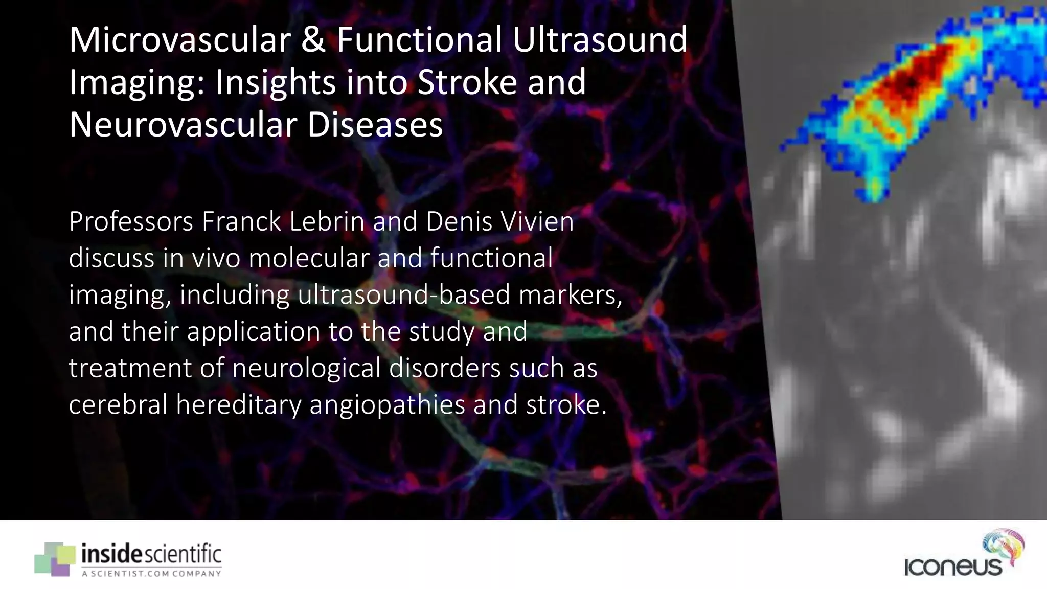 Microvascular & Functional Ultrasound Imaging: Insights into Stroke and ...