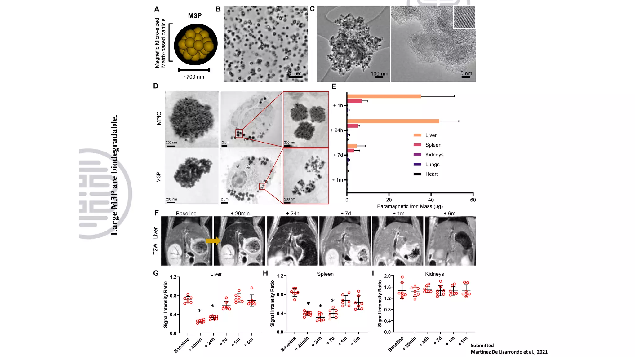 Microvascular & Functional Ultrasound Imaging: Insights into Stroke and ...