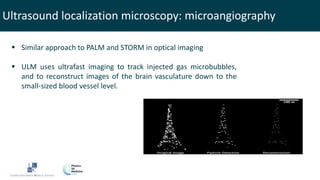 Microvascular & Functional Ultrasound Imaging: Insights into Stroke and ...