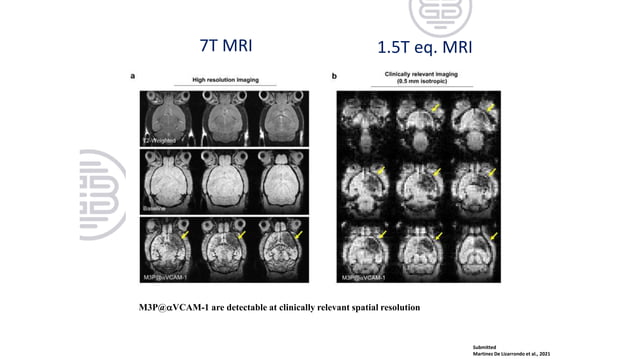 Microvascular & Functional Ultrasound Imaging: Insights into Stroke and ...