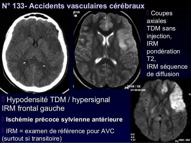 Images of AVC-Intra - JapaneseClass.jp