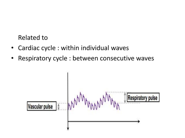 Intracranial pressure - waveforms and monitoring | PPSX
