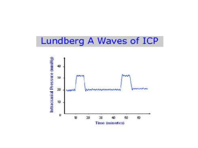 Intracranial pressure - waveforms and monitoring | PPSX