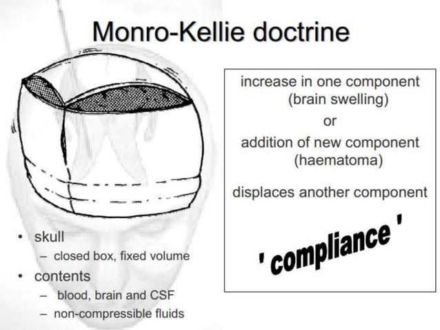 Intracranial pressure - waveforms and monitoring | PPSX