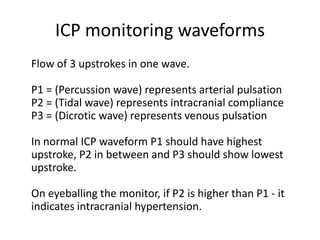 Intracranial Pressure Waveform