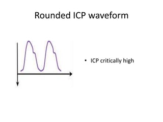 Intracranial Pressure Waveform