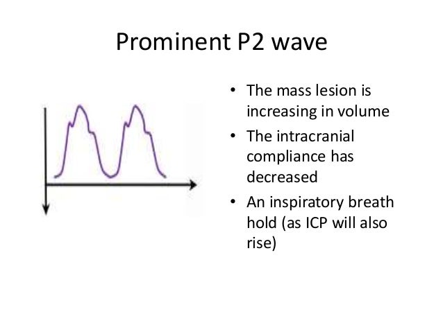 Intracranial pressure - waveforms and monitoring