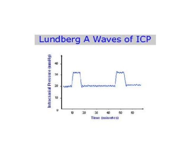 Intracranial pressure - waveforms and monitoring
