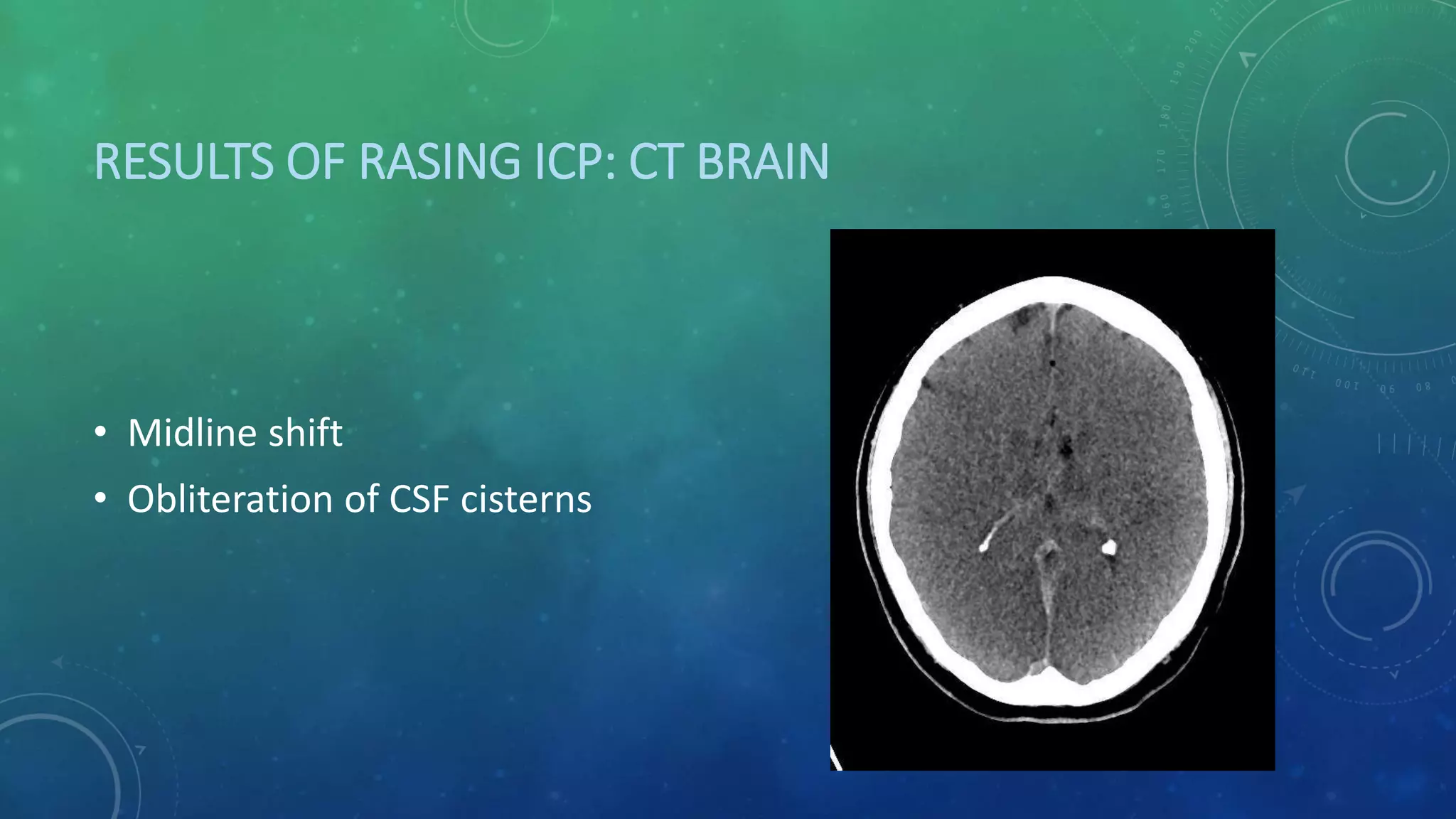 essentials of intracranial pressure (ICP) | PPTX | Brain and Nervous System Disorders | Diseases ...