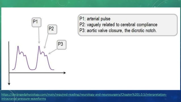 essentials of intracranial pressure (ICP) | PPTX | Brain and Nervous ...