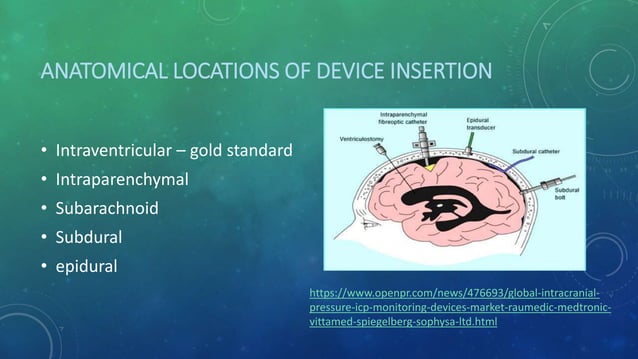 essentials of intracranial pressure (ICP) | PPTX | Brain and Nervous ...